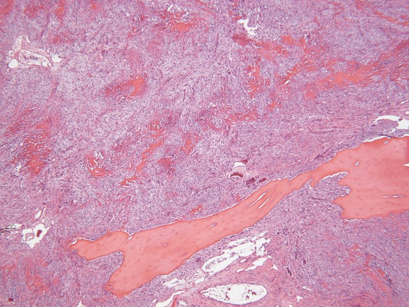 Vetmeduni: Osteosarcoma