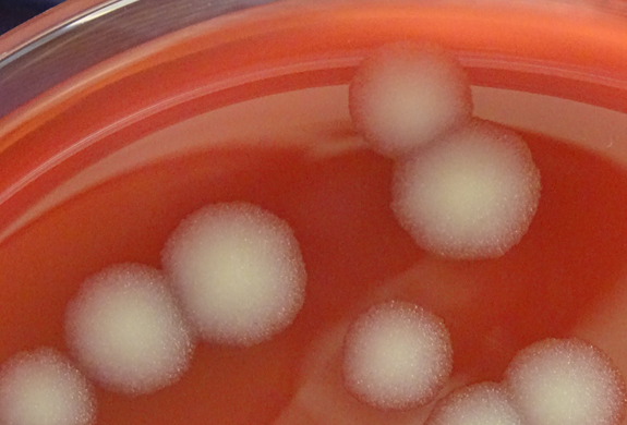 Vetmeduni : Anthrax: a lurking threat to humans and animals