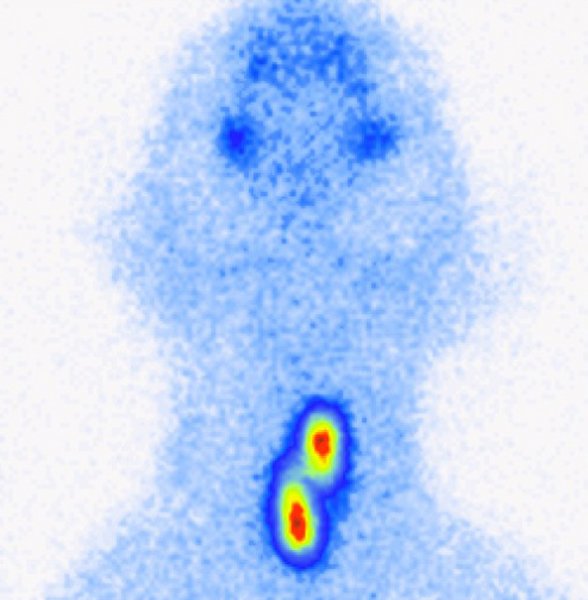 Vetmeduni: Szintigraphie